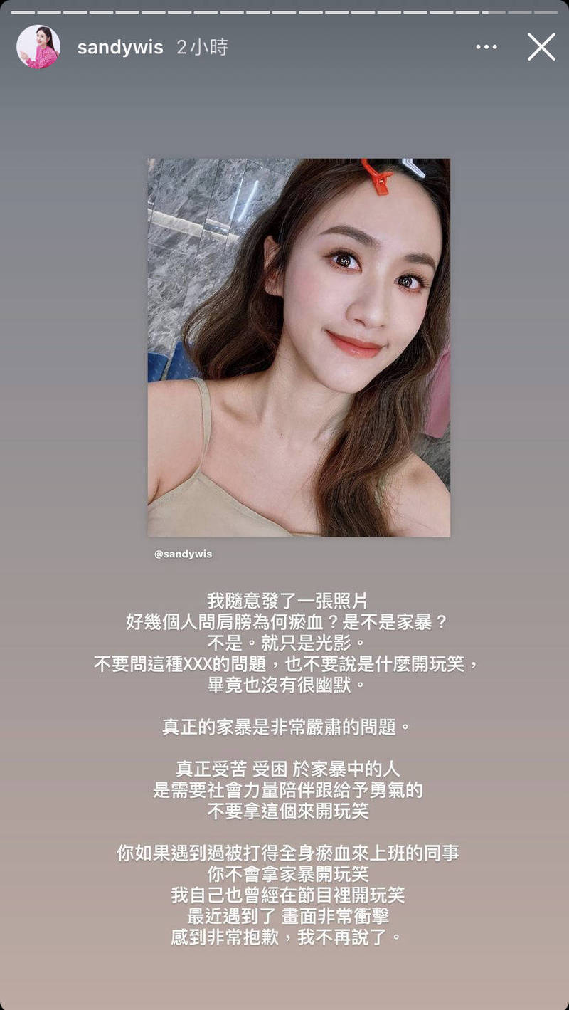 曬照被開家暴玩笑！Sandy曾「目睹實例」嚴斥：沒有很幽默 - 自由娛樂